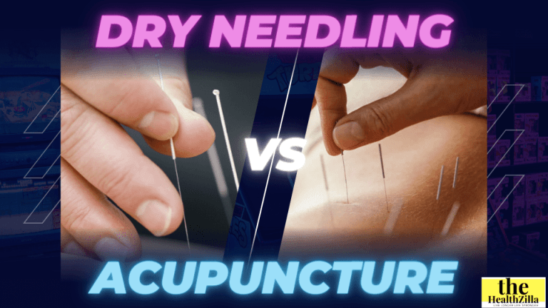 Dry Needling Vs Acupuncture - Benefits & 5 Major Differences